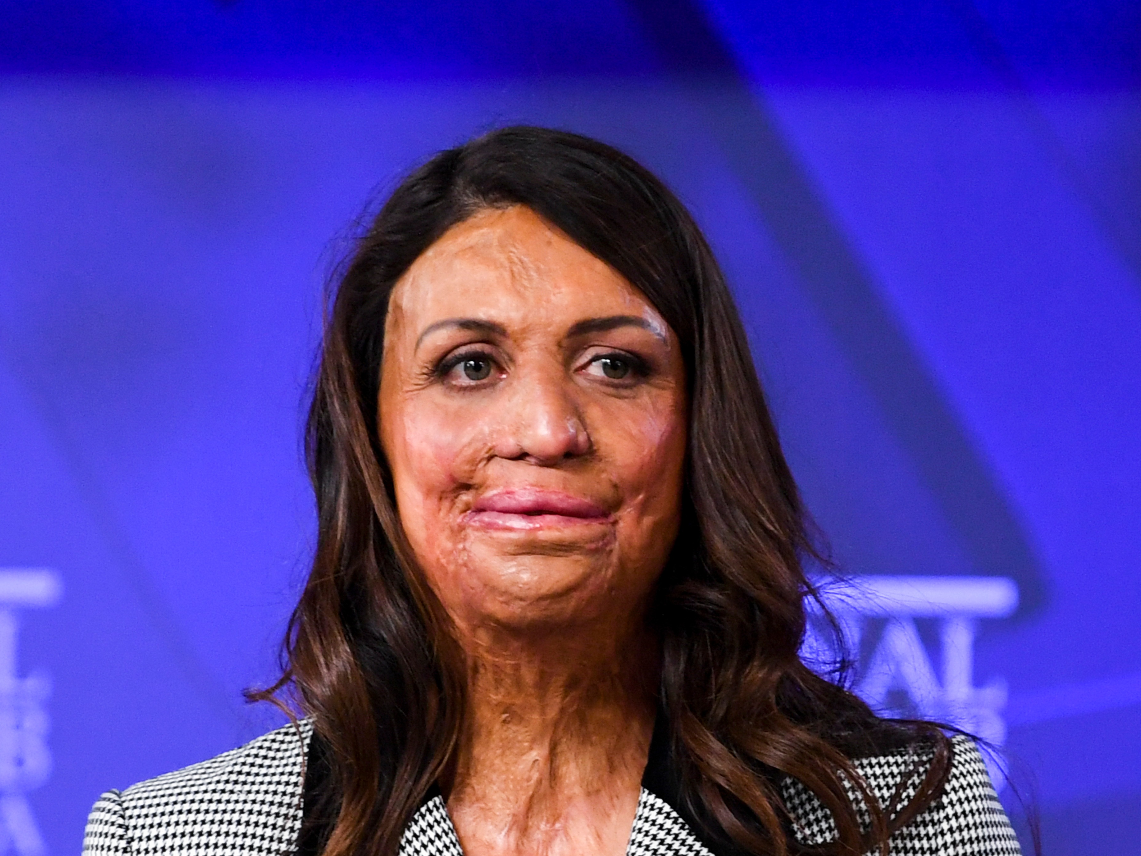 Turia Pitt’s ‘confronting’ discovery