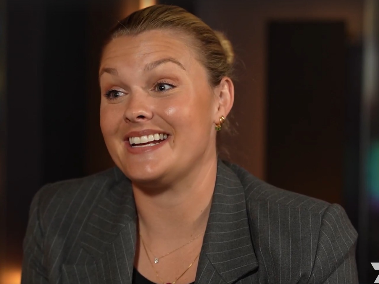 Australian actress Sophie Dillman shares endometriosis struggle